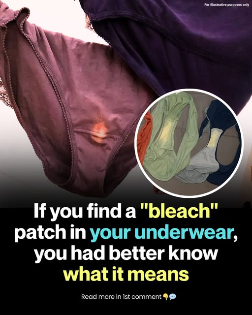 Understanding the Surprising Cause Behind Bleach Patches on Your ...